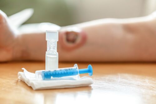 Tips for Documenting Pressure Ulcers Effectively