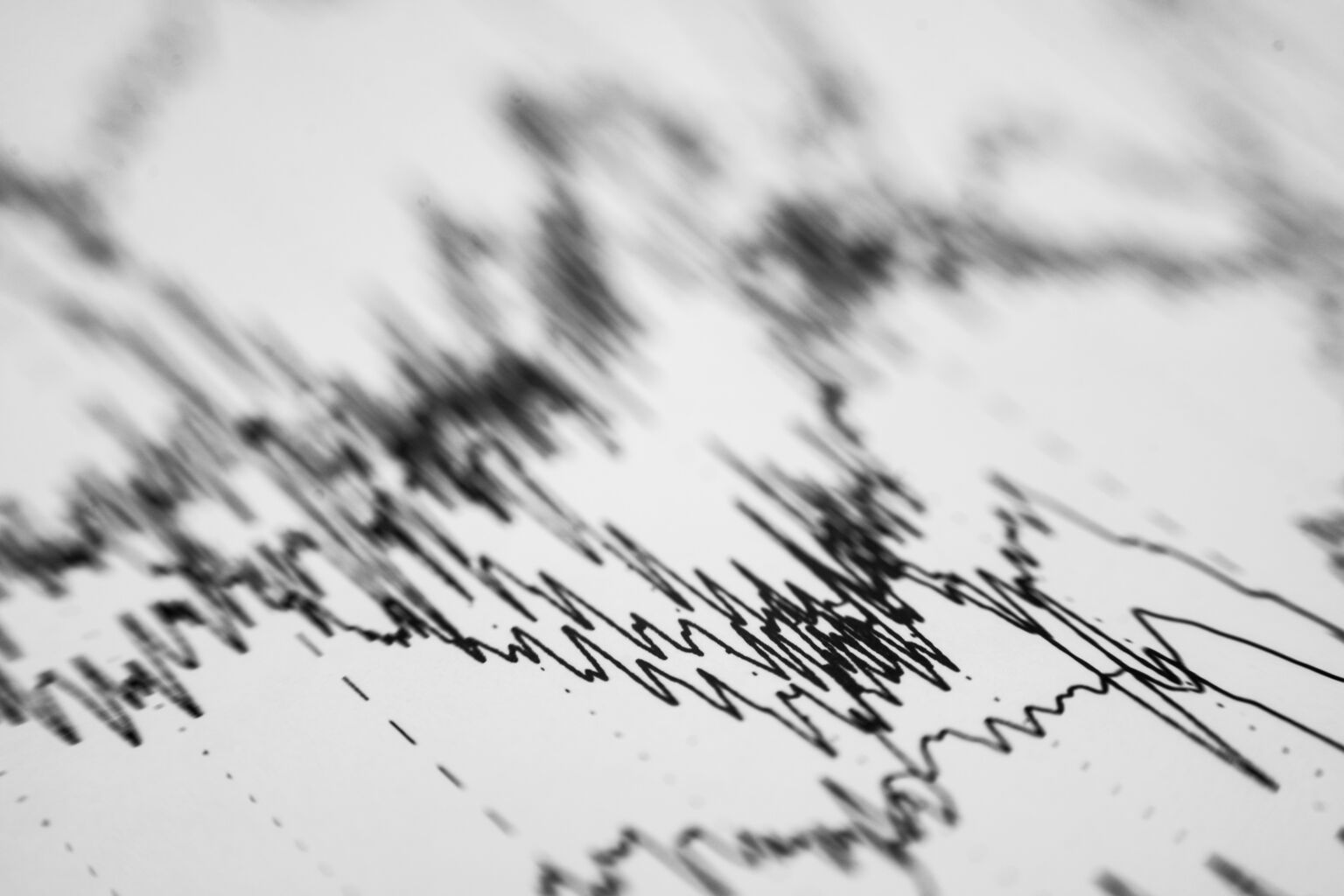 Understanding Absence Seizures | Key Insights and Facts